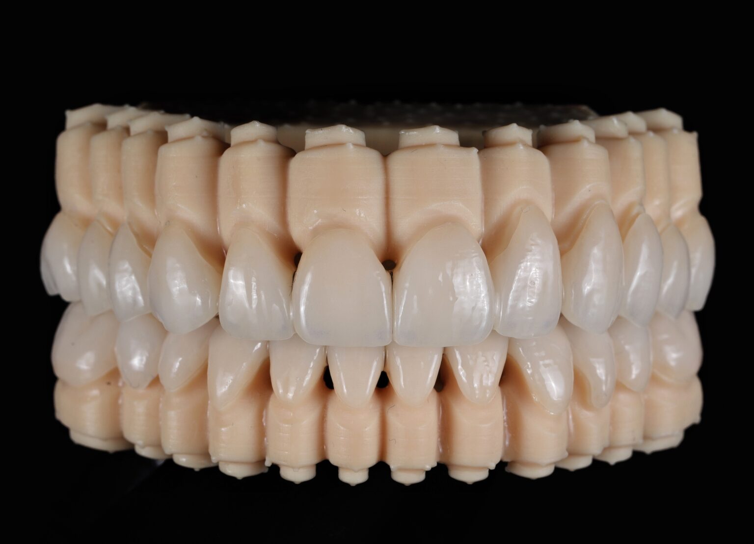 MOD Design Services - Advanced dental design services from a clinician ...